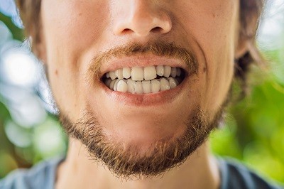 Signs of Bite Issues | Pacific West Dental Blog