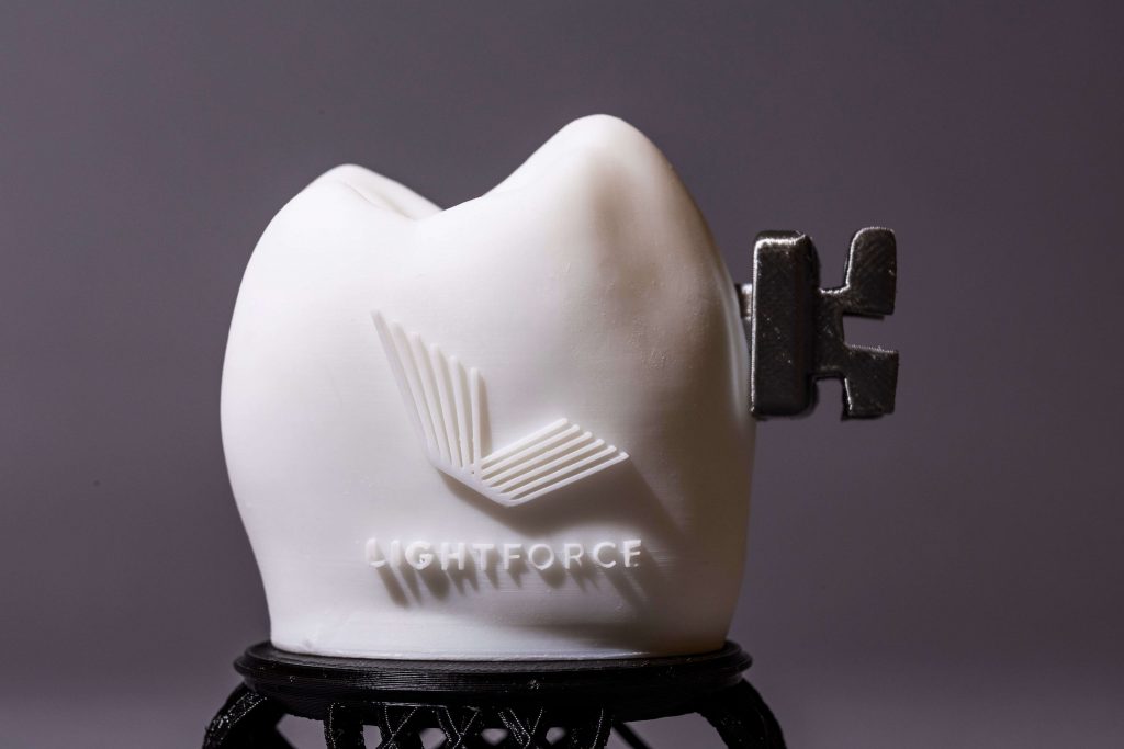 Expert Lightforce Braces | Surrey Pacific West Dental